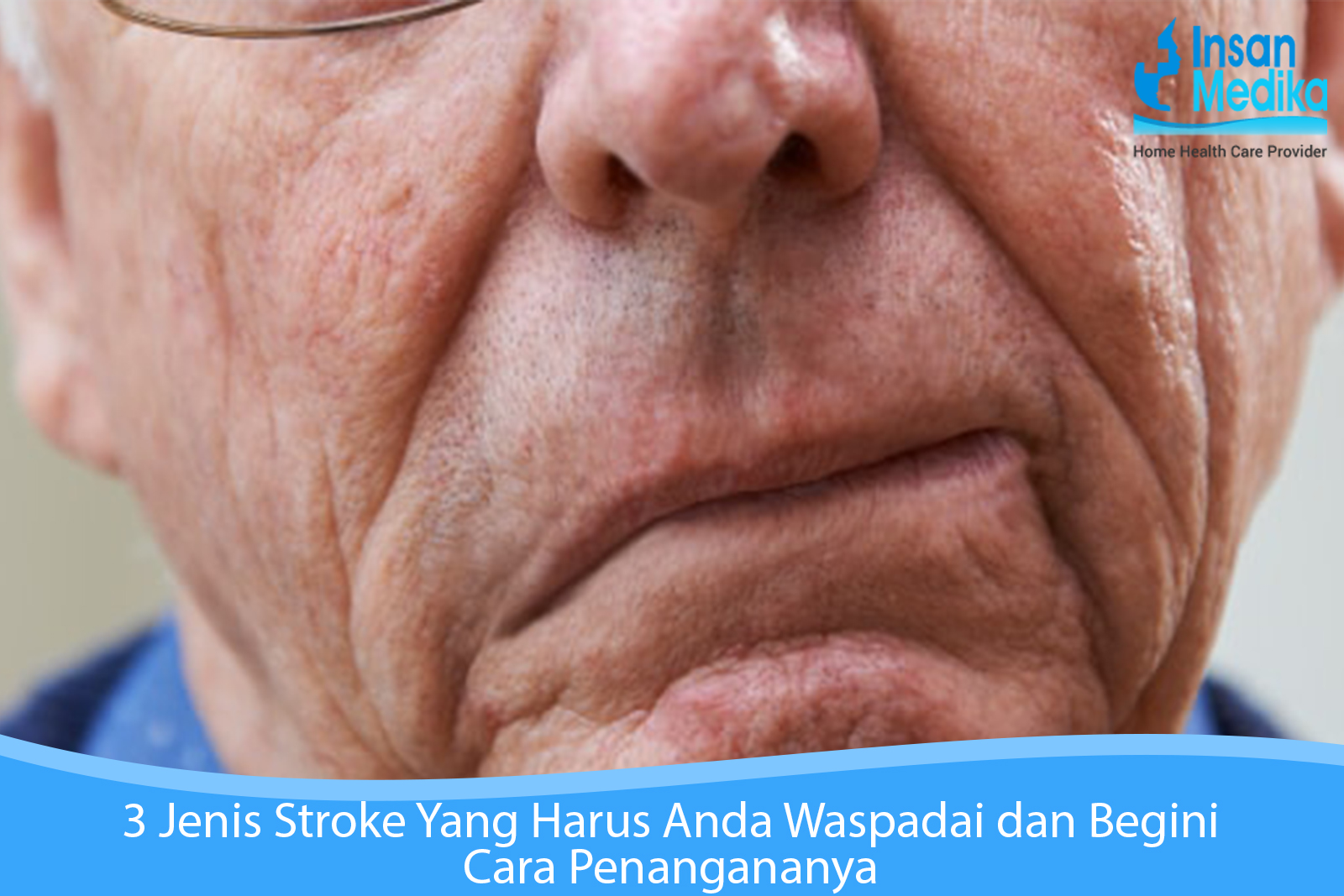 Jenis Stroke yang Perlu Diwaspadai dan Cara Penangananya - Blog Insan ...